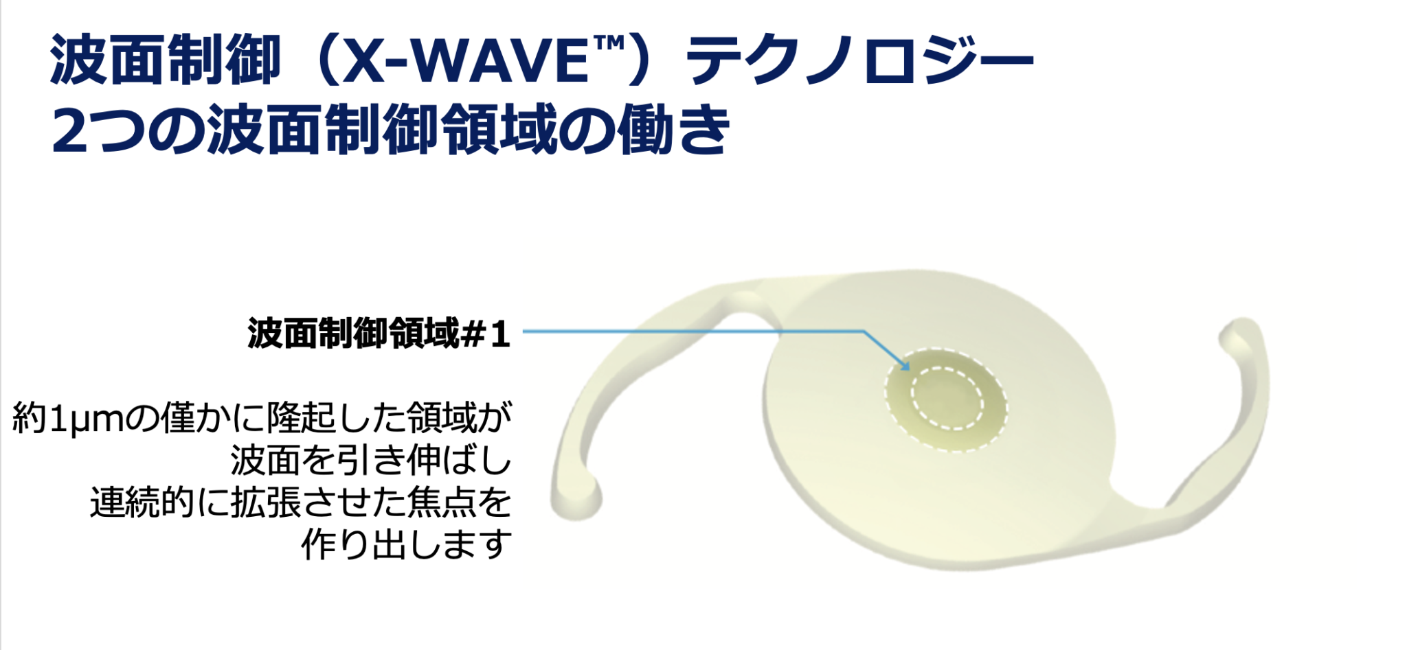 クラレオン・ビビティ(Clareon Vivity)の特徴を大宮七里眼科・山﨑健一朗院長が解説